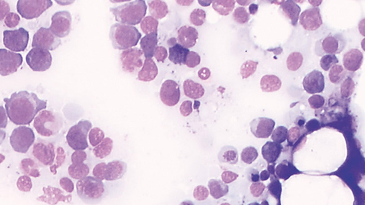 Hämatologischer Mikroskopierkurs - St. Antonius Hospital Eschweiler